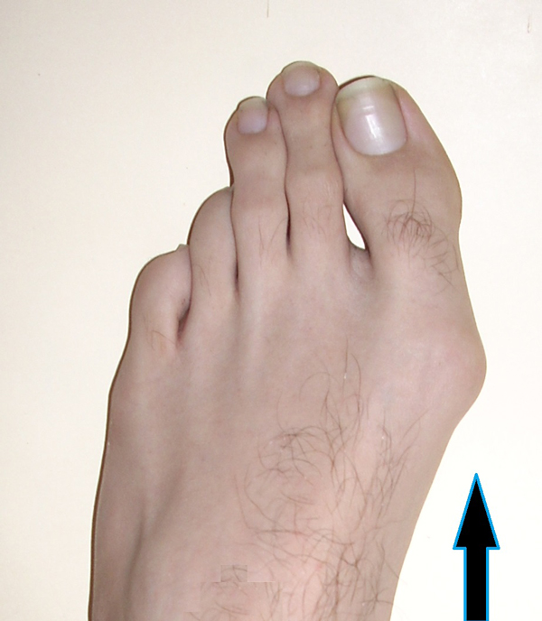 Common Foot Conditions | Podiatry Associates of Virginia